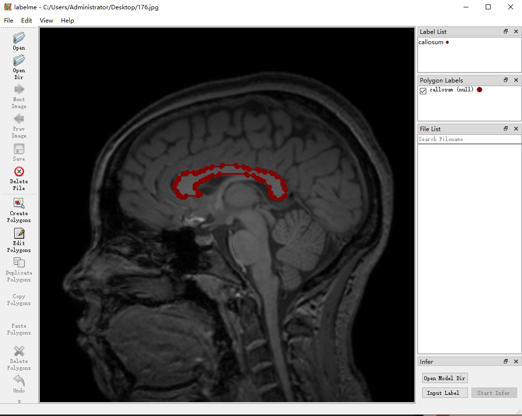 Labelme与FastDeploy相结合，辅助分割标注 - 飞桨AI Studio星河社区